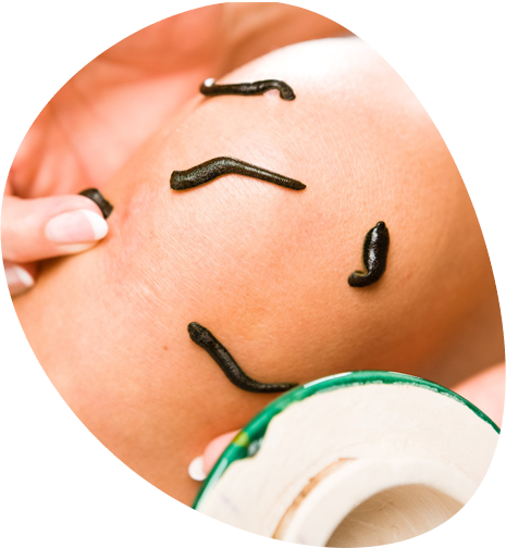 Leech therapy London - Home - Medicinal Leech Therapy Centre UK