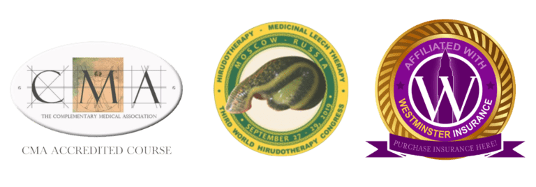 What Is Leech Therapy? | Medicinal Hirudotherapy Explained